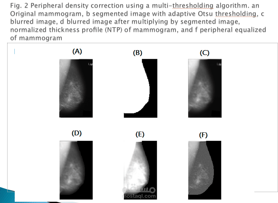 Computer-Aided Diagnosis System for Masses Classification (benign - malignant) in Digital ...