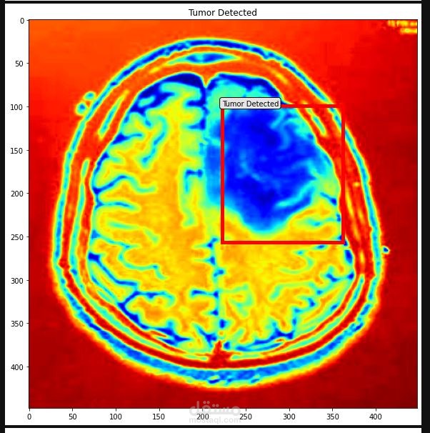 Brain-Tumor-Classification-Based-on-deep-learning | مستقل