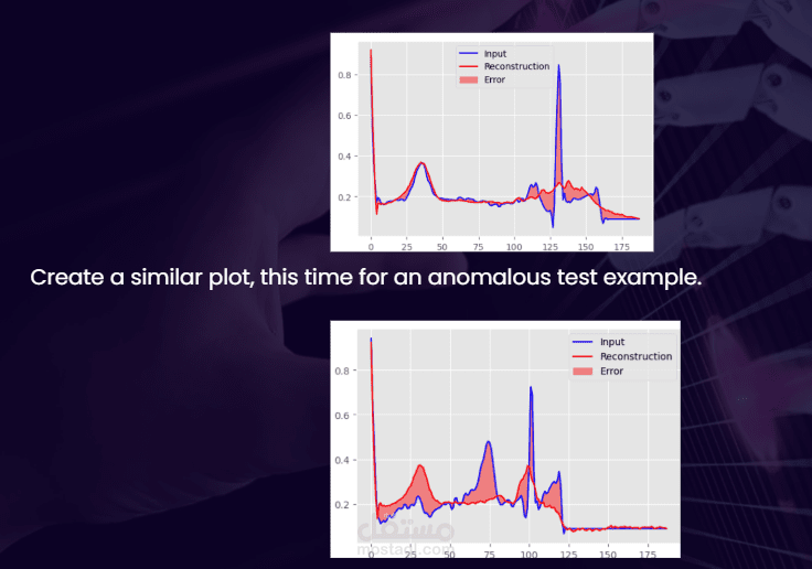 ECG signal anomaly detection | مستقل