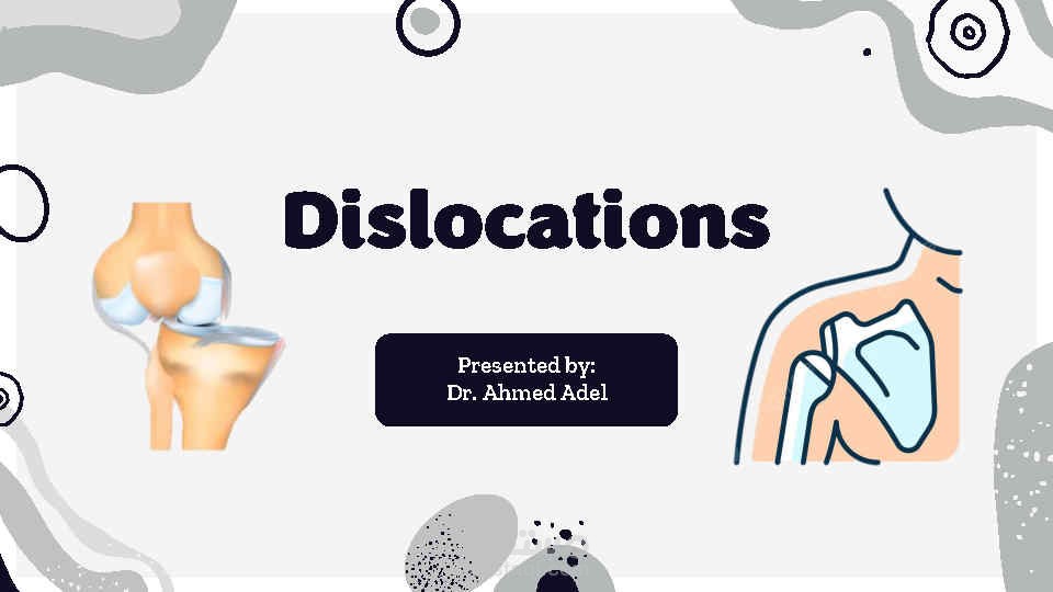 Dislocations PowerPoint | مستقل