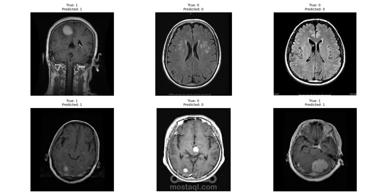Brain Tumor Classification Using Deep Learning (VGG16 Model) | مستقل Brain Tumor Classification Using Deep Learning (VGG16 Model) | مستقل