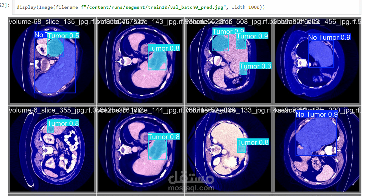 Liver-tumor-segmentation | مستقل
