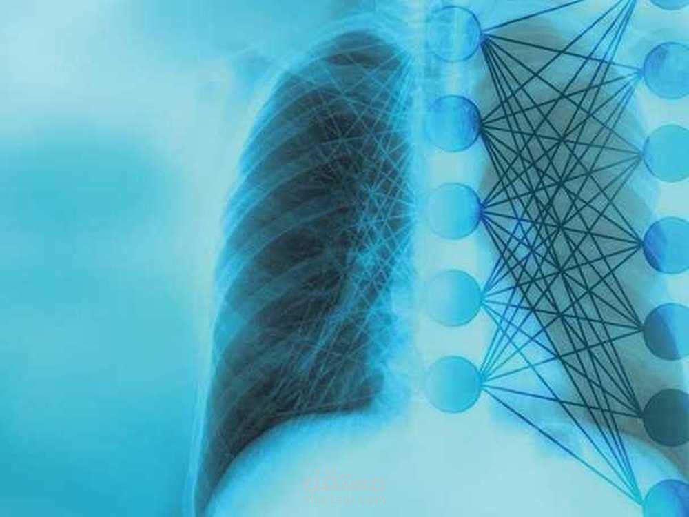 Pneumonia Detection | مستقل