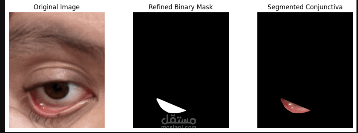 Conjunctiva Segmentation | مستقل