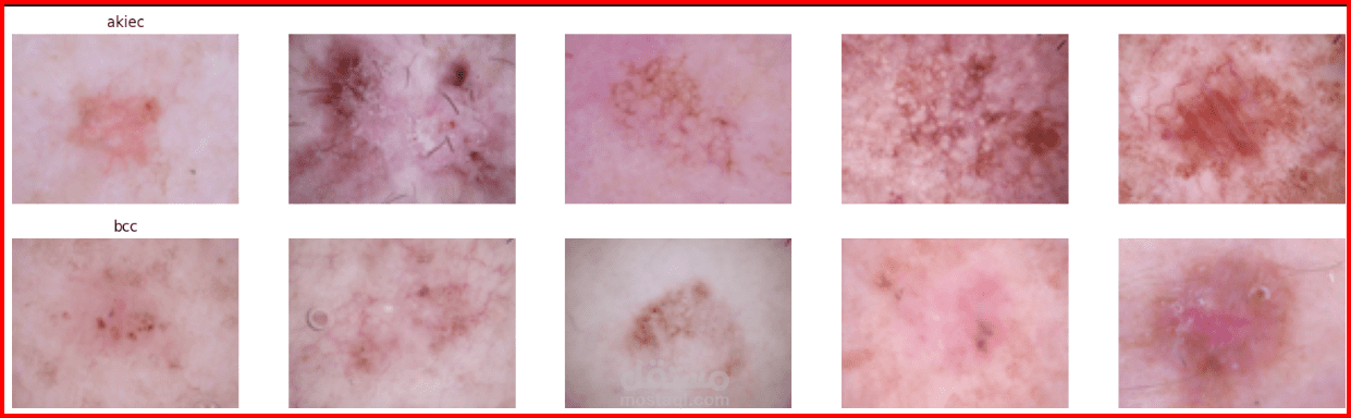A Robust Skin Cancer Classification using Deep Learning | مستقل